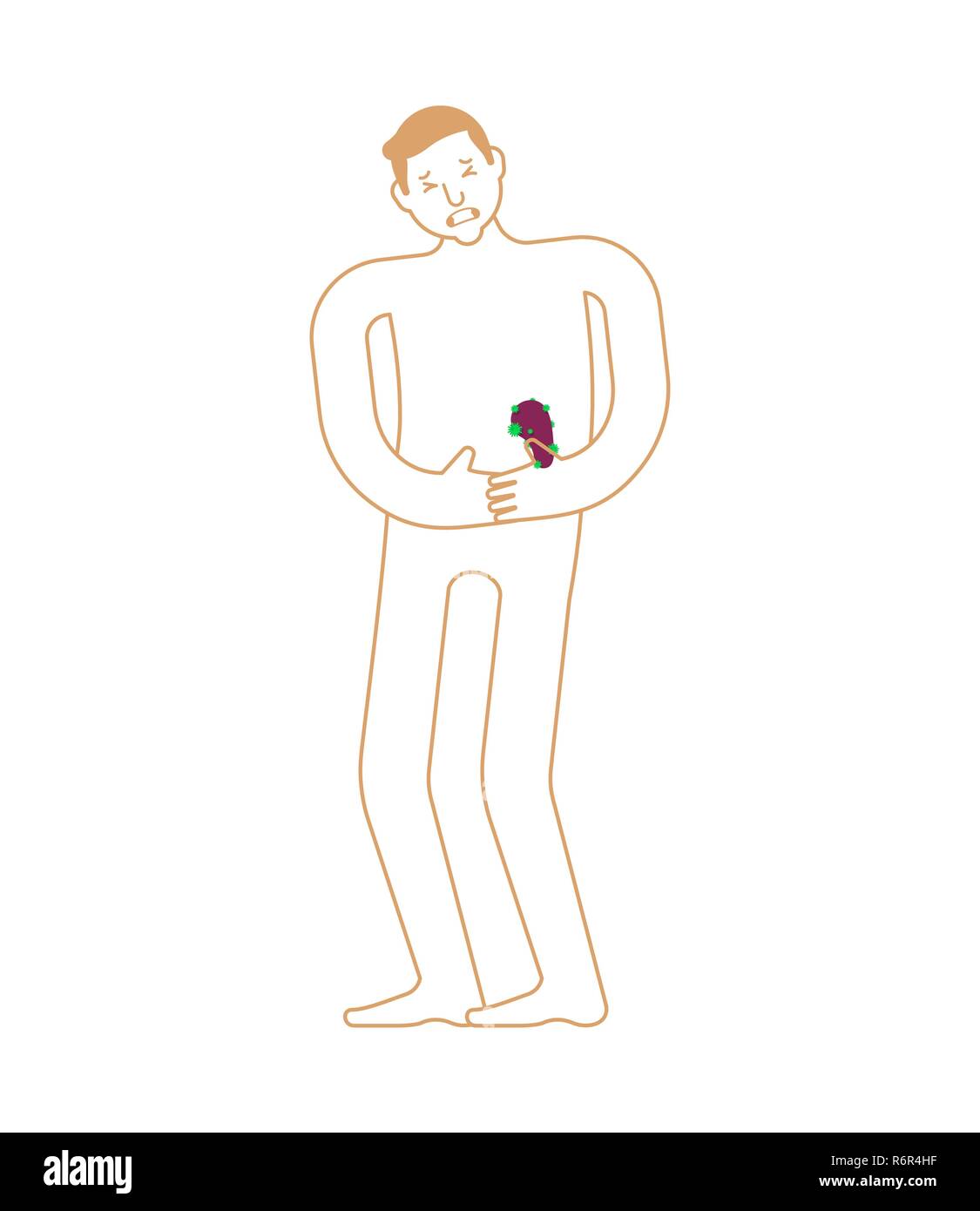 Sick Spleen Anatomy of human disease. Diseased internal organ. Aching ...