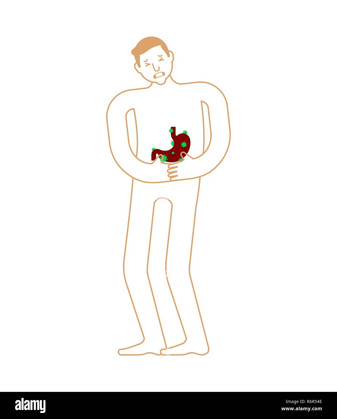 Sick stomach Anatomy of human disease. Diseased internal organ. Aching ...