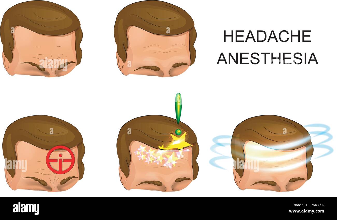 Tension headache relief Stock Vector Images - Alamy