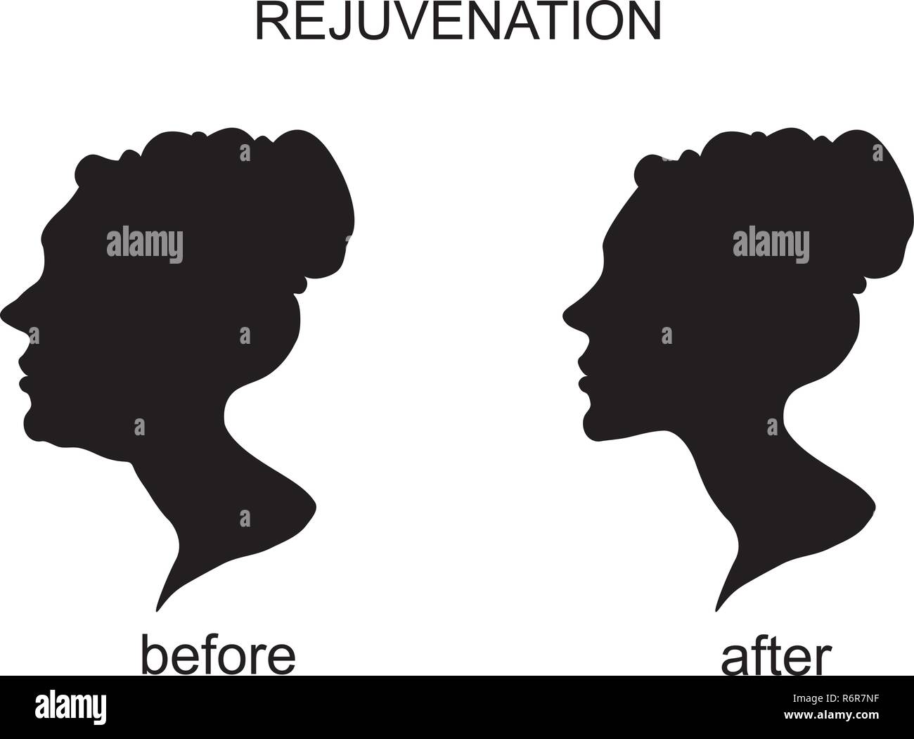 Illustration of icons for rejuvenation before and after.a face-lift ...