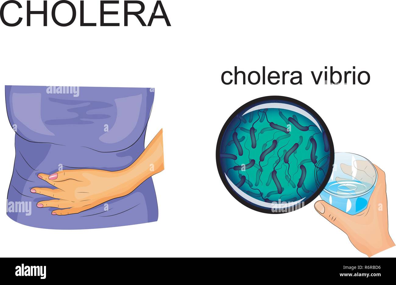Cholera Bacteria Diagram