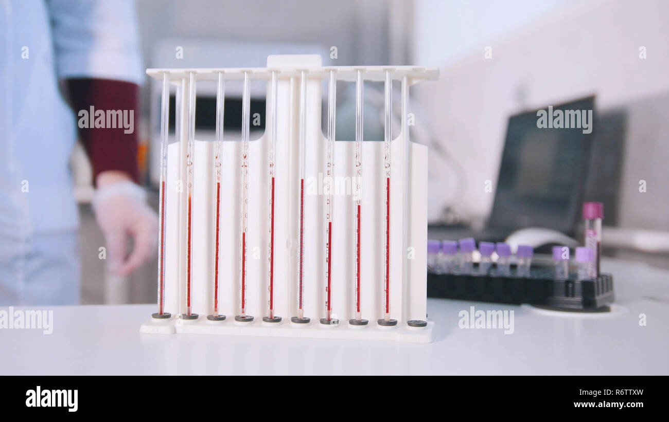 Flasks with different blood samples in medical laboratory Stock Photo ...