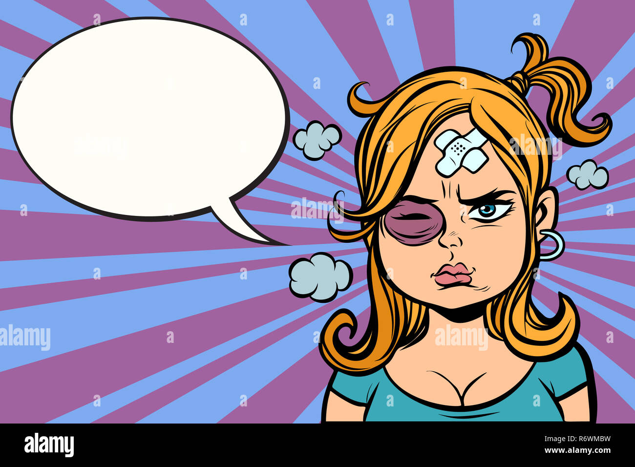 Woman with a black eye, victim after fight Stock Photo - Alamy