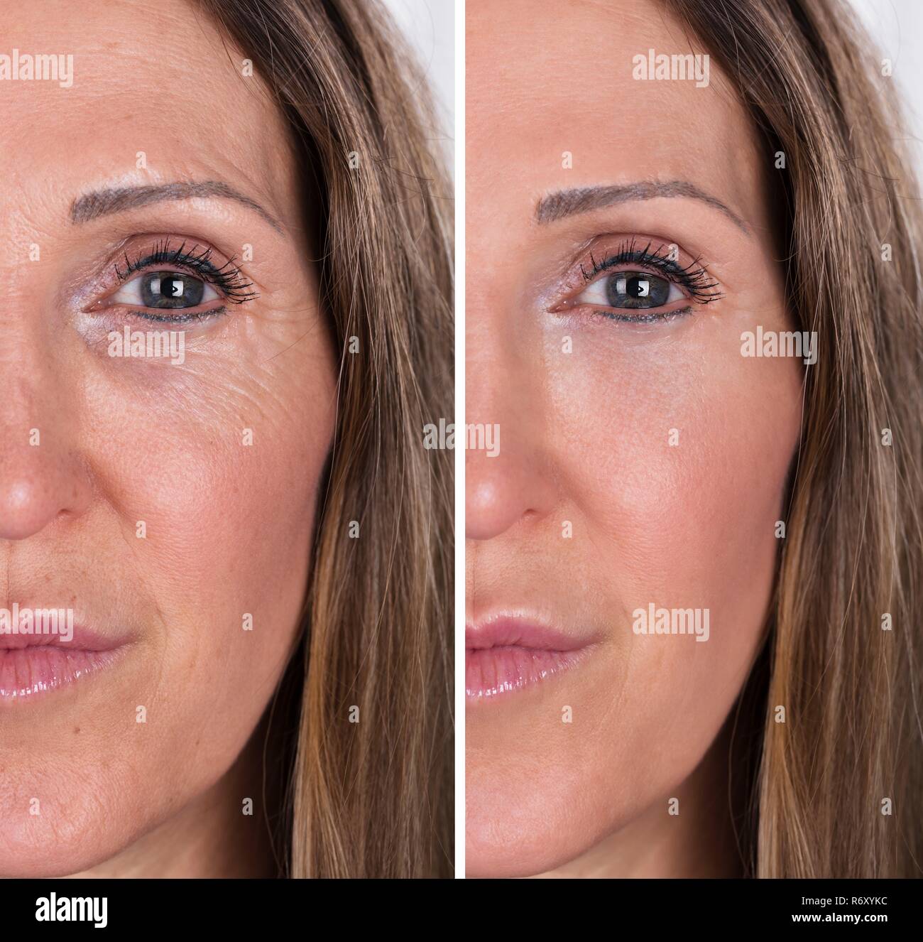 Woman With Before And After Rejuvenation Stock Photo - Alamy