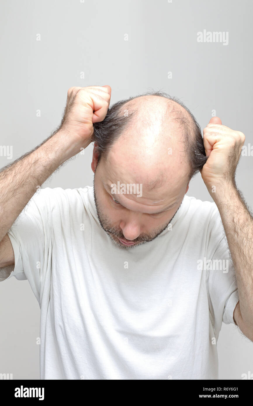 Pulling Hair Man Stock Photo - Alamy