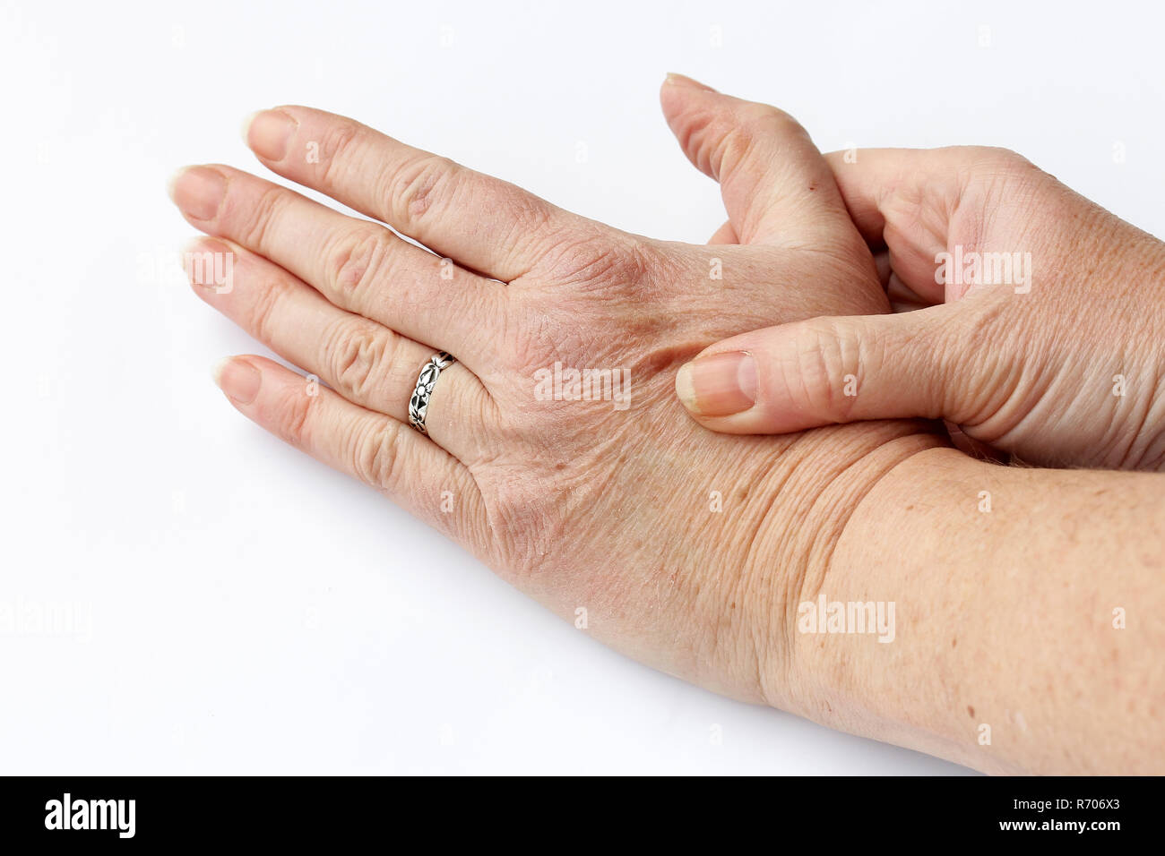 Arthrose hand hi-res stock photography and images - Alamy