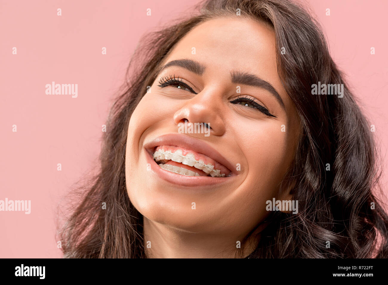 Dental overbite hi-res stock photography and images - Alamy