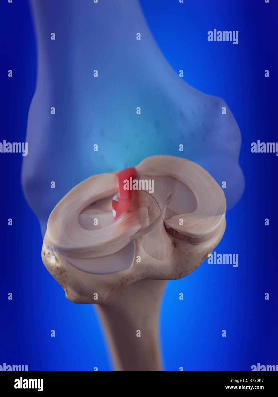 3d rendered illustration of the anterior cruciate ligament Stock Photo ...