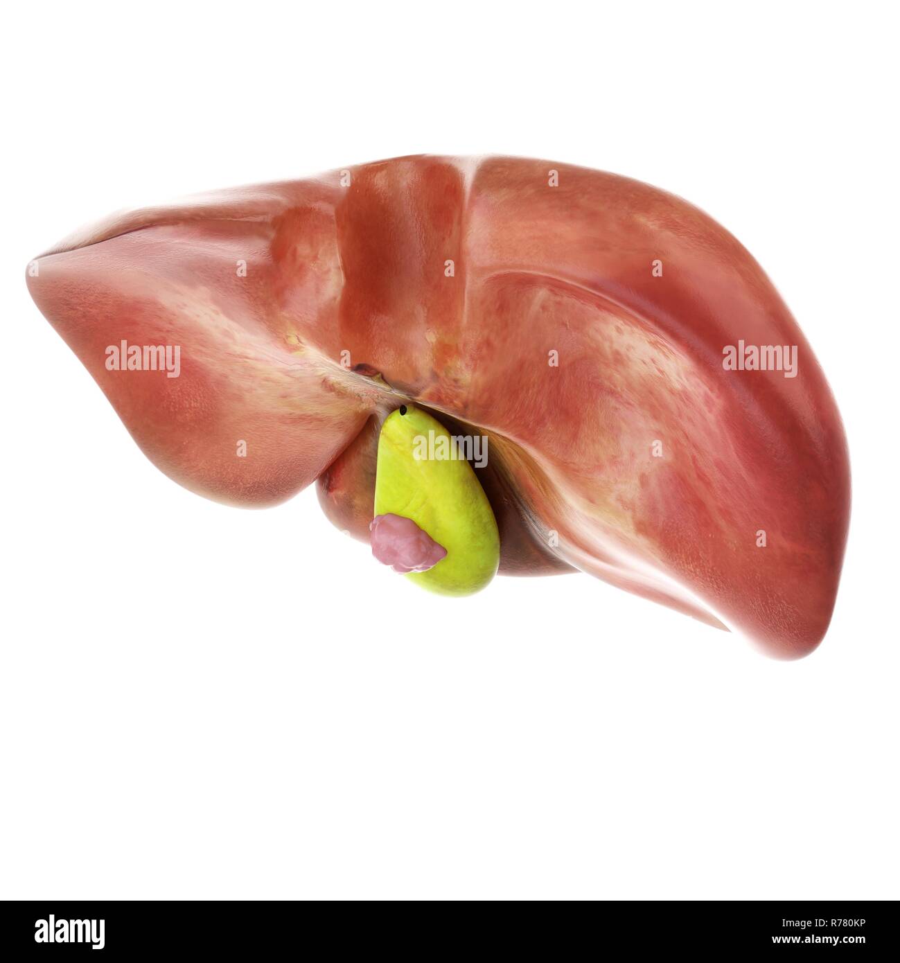 Gallbladder cancer hi-res stock photography and images - Alamy