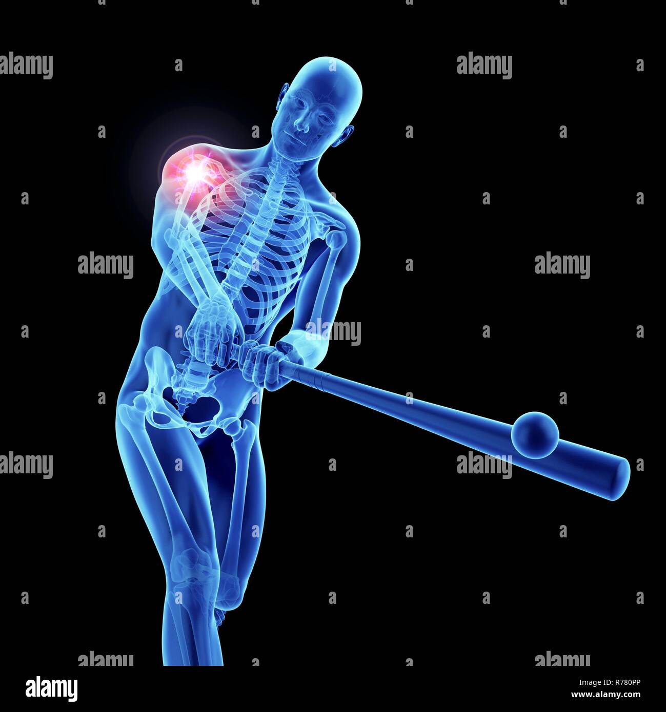 3d rendered illustration of an athlete's painful shoulder Stock Photo ...