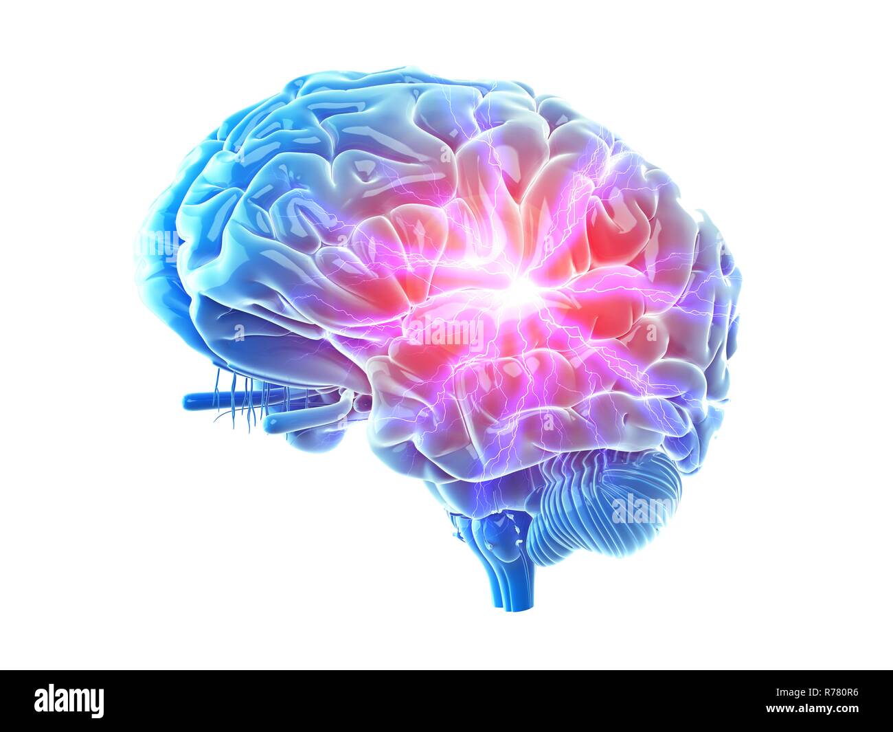 Inflamed brain hi-res stock photography and images - Alamy