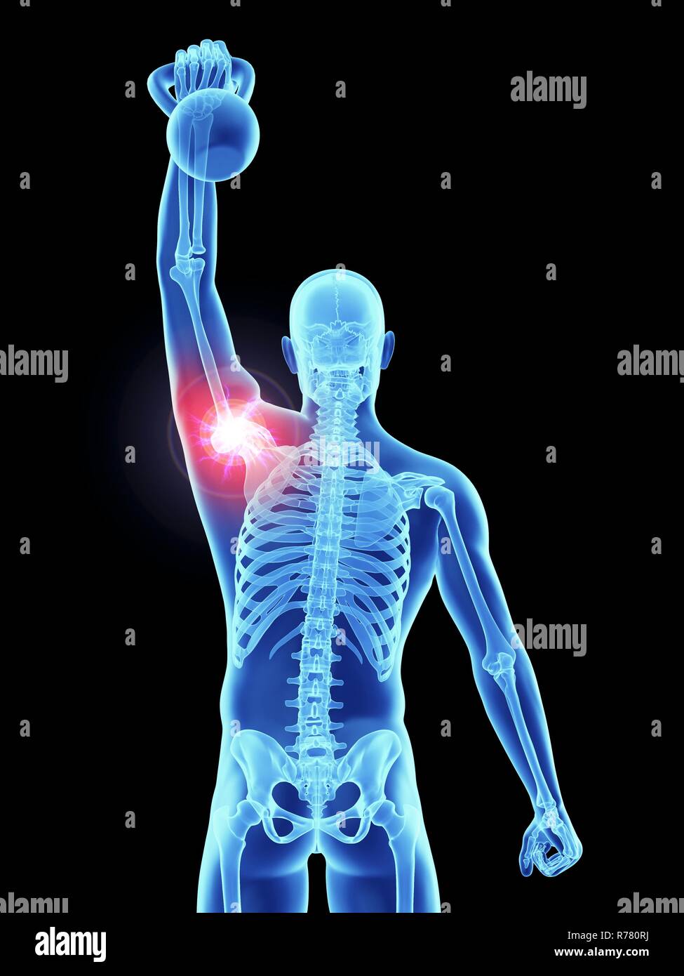 3d rendered illustration of an athlete's painful shoulder joint Stock ...