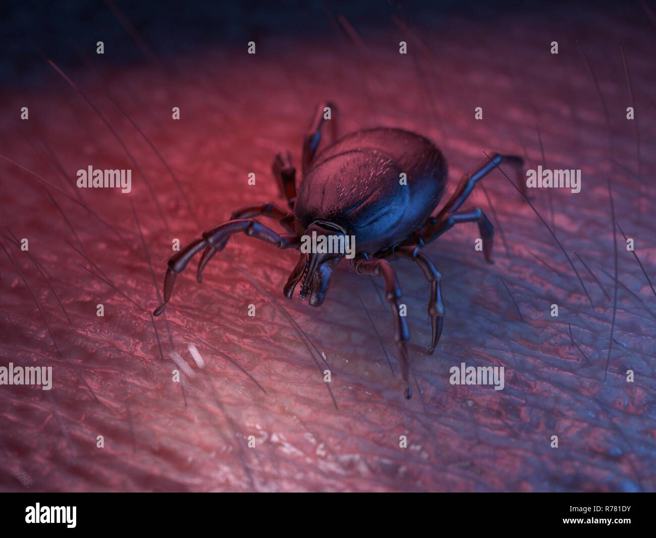 Tick on skin hi-res stock photography and images - Alamy
