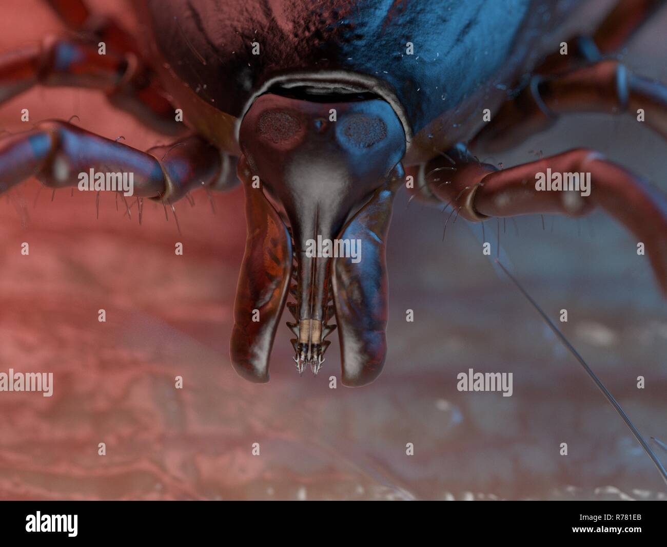 3d rendered illustration of a tick on human skin Stock Photo - Alamy