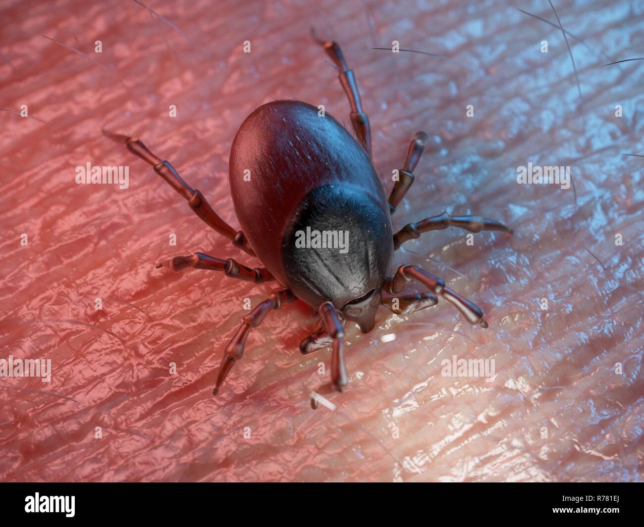 3d rendered illustration of a tick on human skin Stock Photo - Alamy