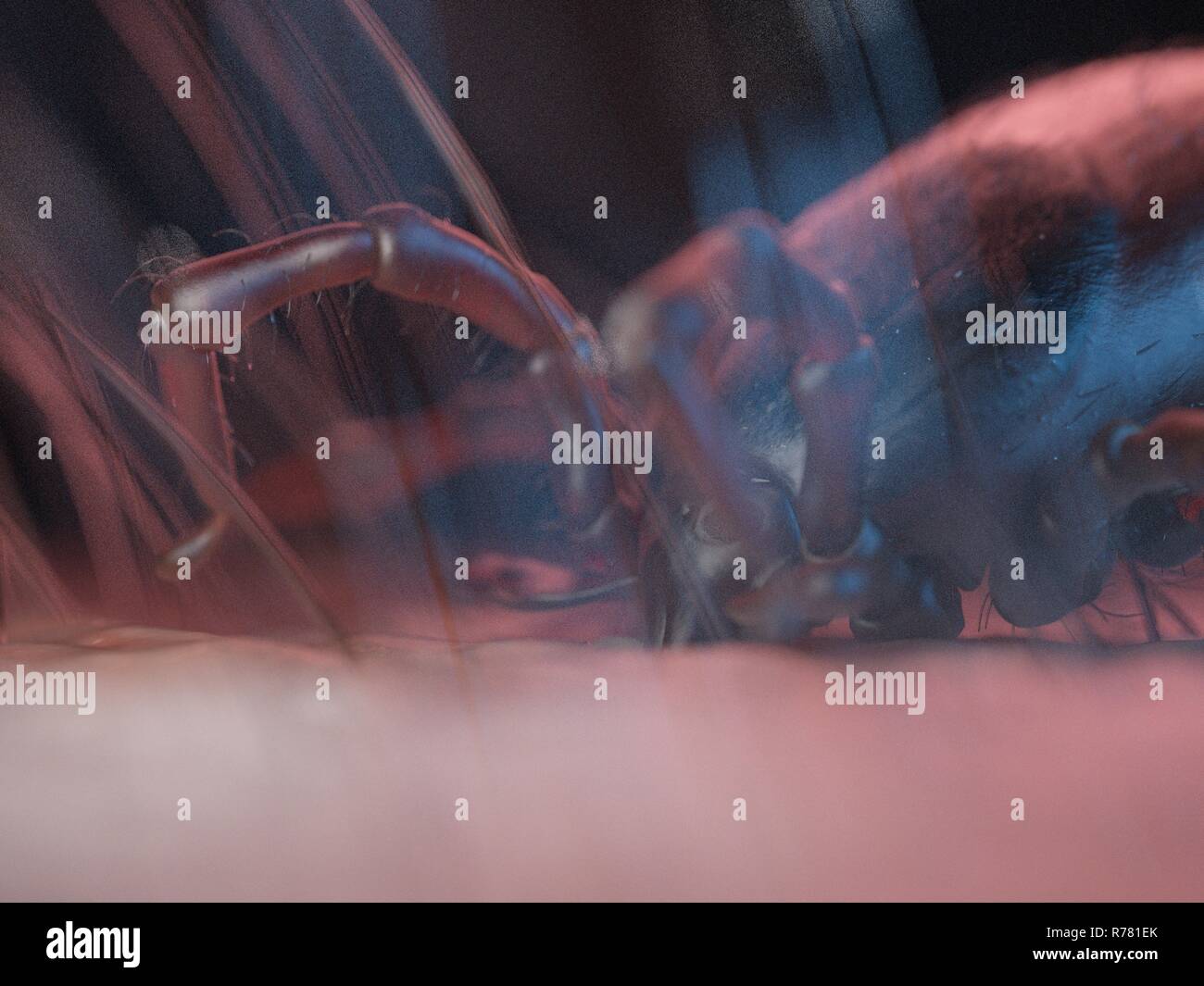 3d rendered illustration of tick in human skin Stock Photo - Alamy