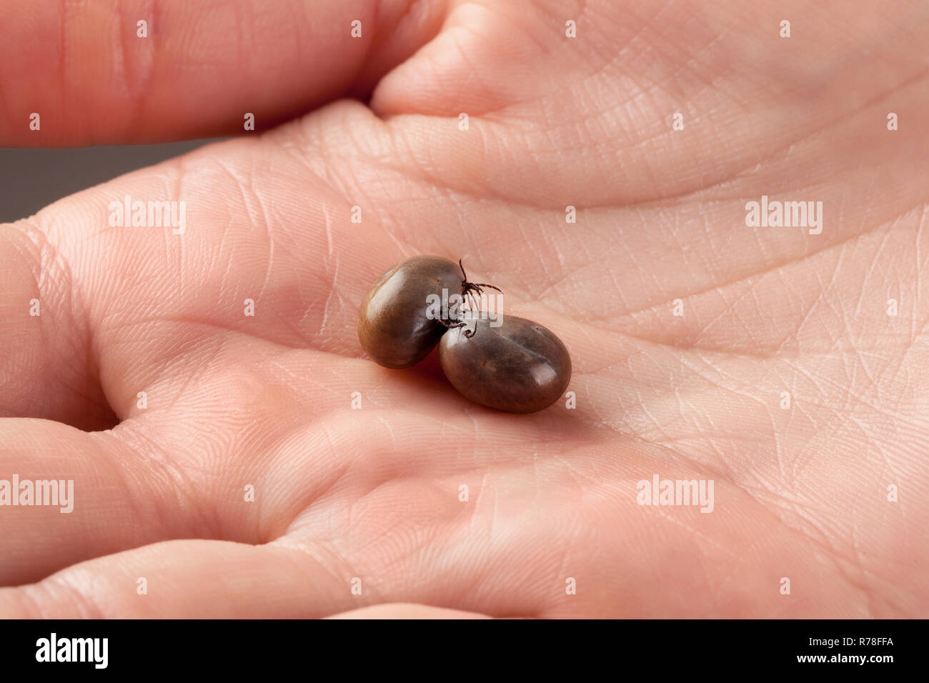 Ticks full of blood in hand Stock Photo - Alamy