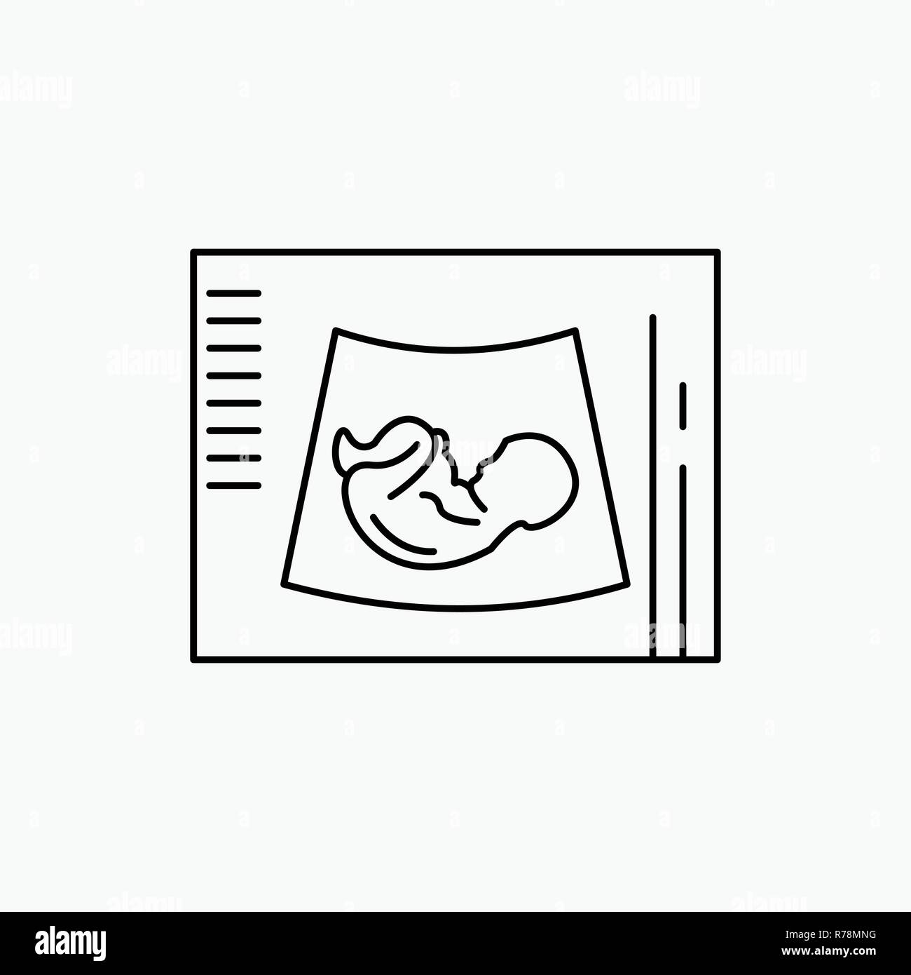 Pregnancy Ultrasound And Couple Stock Vector Images - Alamy