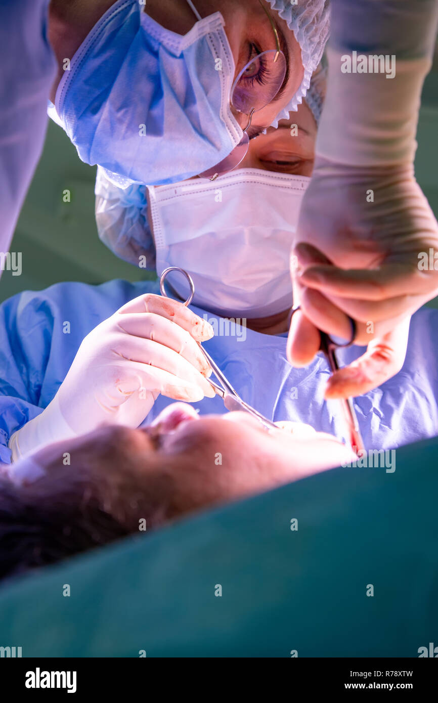 Chin reduction augmentation double chin removal plastic surgery ...