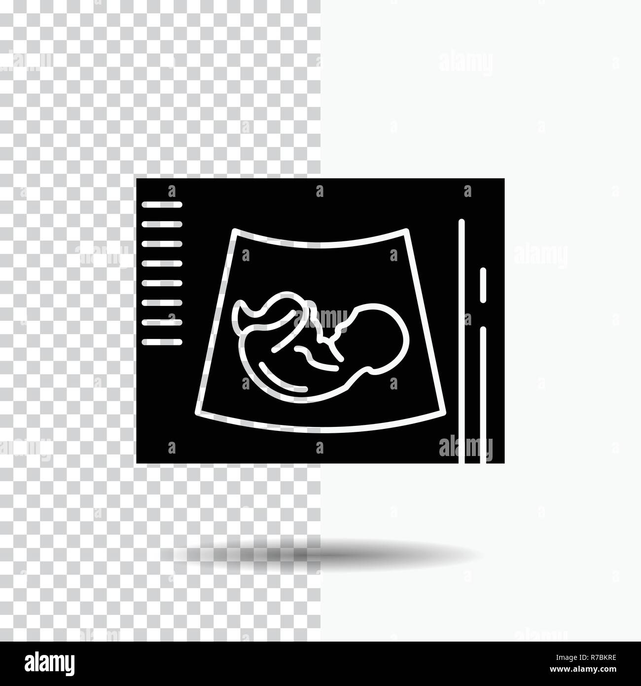 Ultrasound scan picture Stock Vector Images - Alamy
