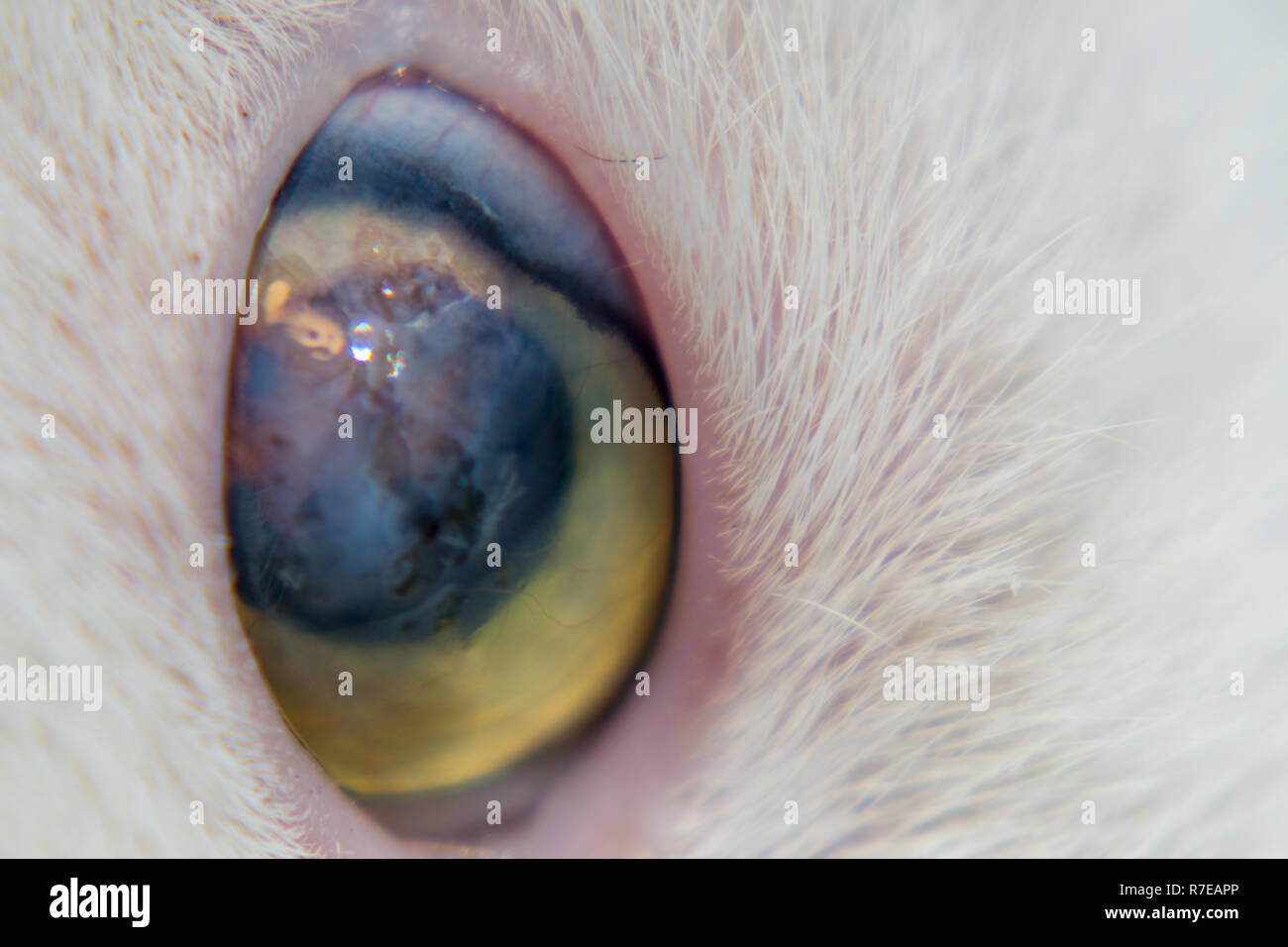 Teratoma hi-res stock photography and images - Alamy