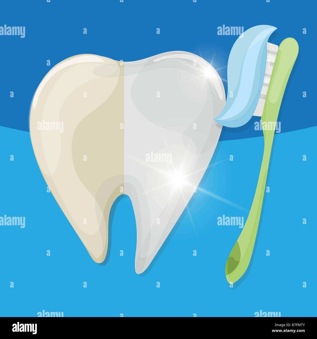 Professional Teeth Whitening, Healthy and yellow Tooth, vector ...