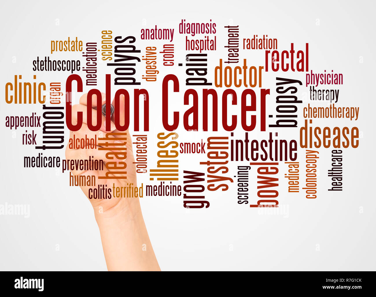 Colon Cancer word cloud and hand with marker concept on white ...