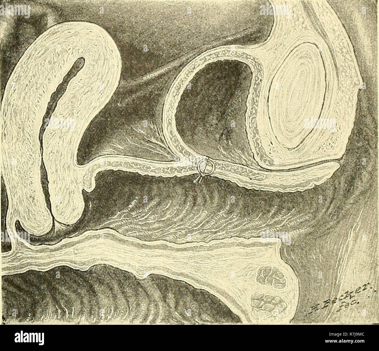 "Operative gynecology :" (1906 Stock Photo - Alamy