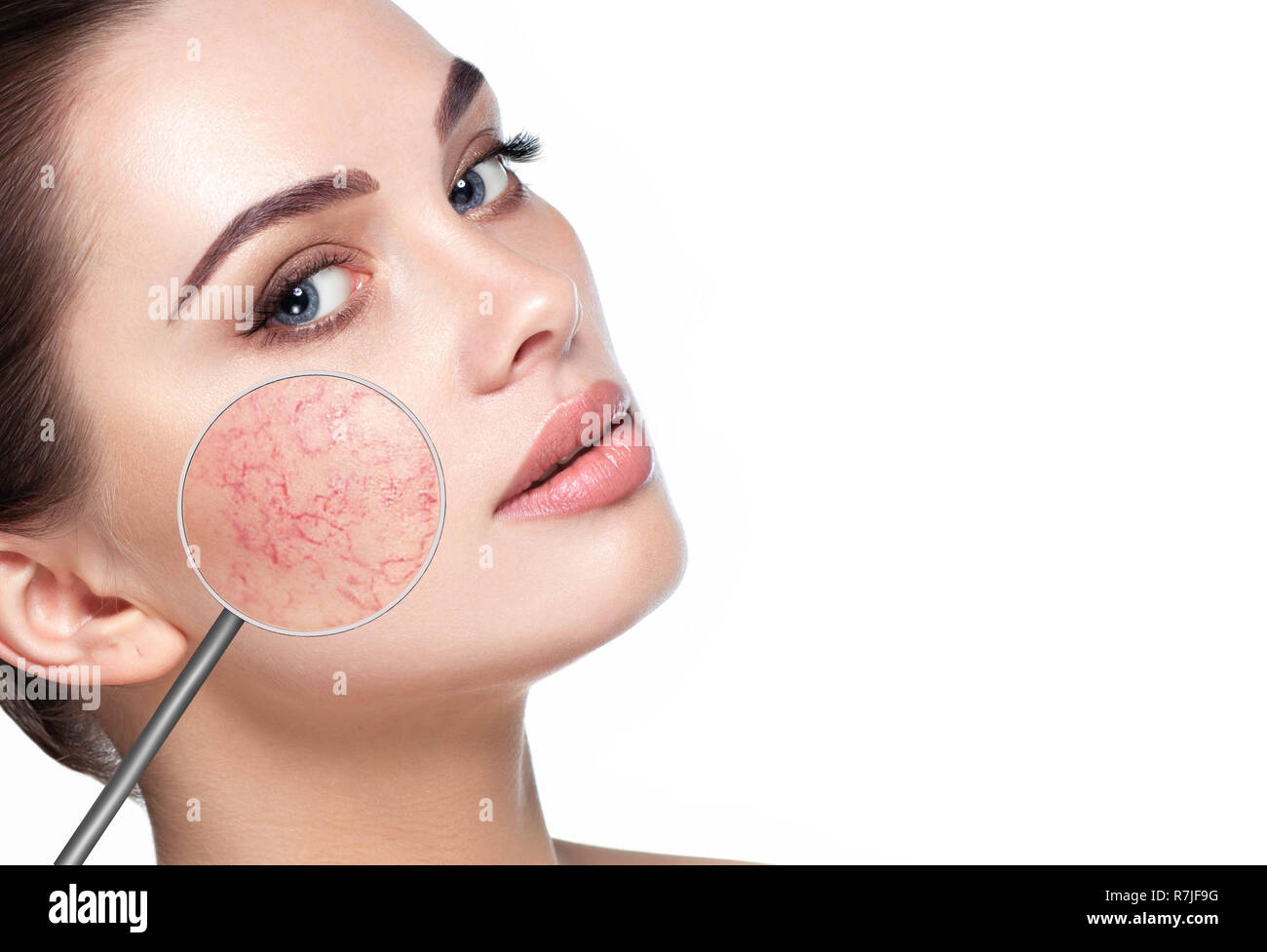 Magnifying glass skin hi-res stock photography and images - Alamy