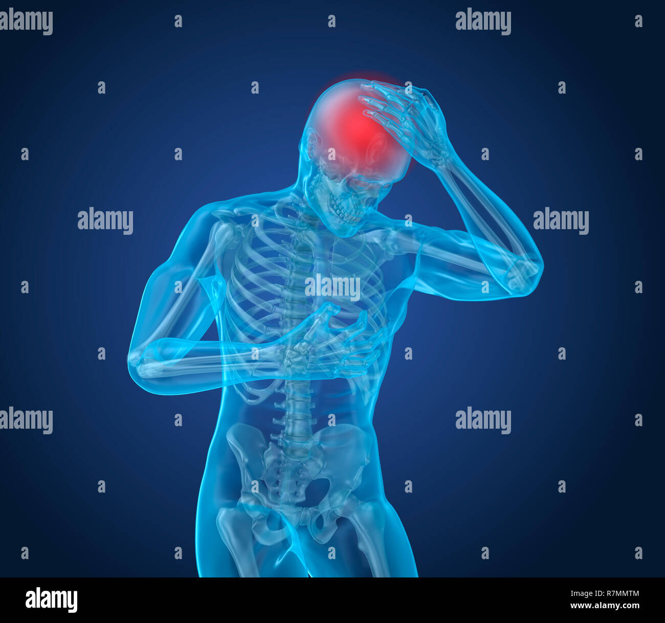 Head pain Attack, man suffering from brain pain. 3D illustration Stock ...