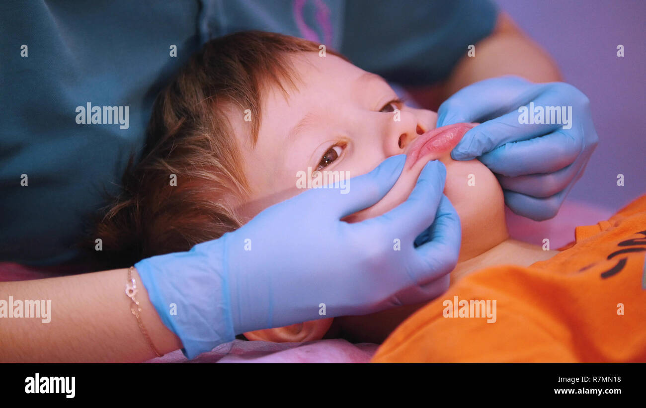 Medicine clinic. A baby with cerebral palsy disease receiving a muscle ...