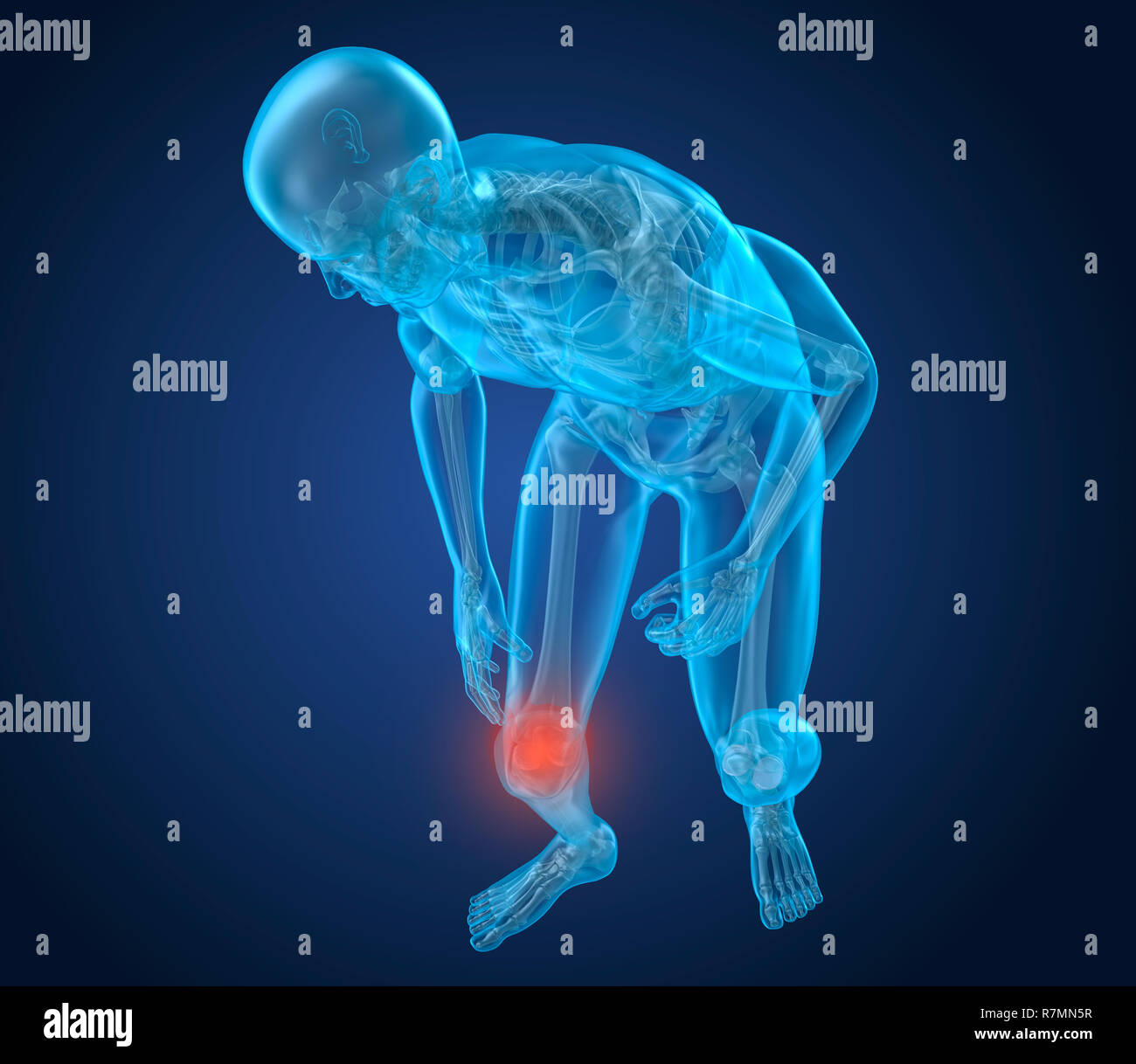 knee pain Attack, man suffering from spinal knee. 3D illustration Stock ...