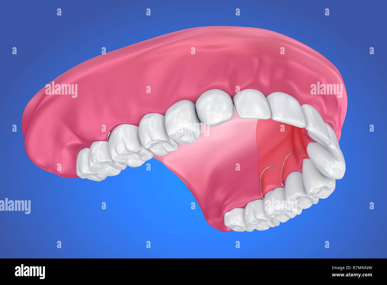 Rpd hi-res stock photography and images - Alamy