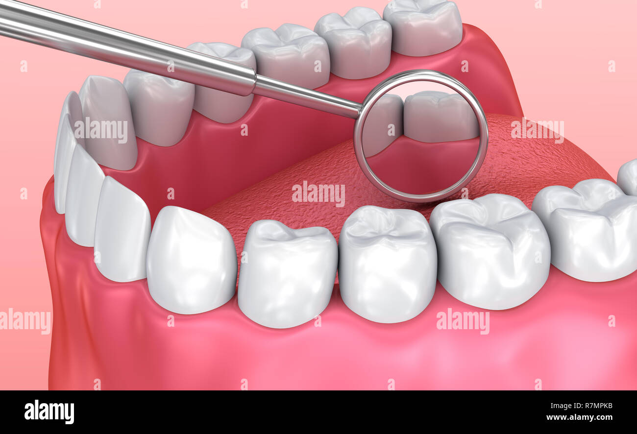 Teeth inspection with mirror. Medically accurate tooth 3D illustration ...