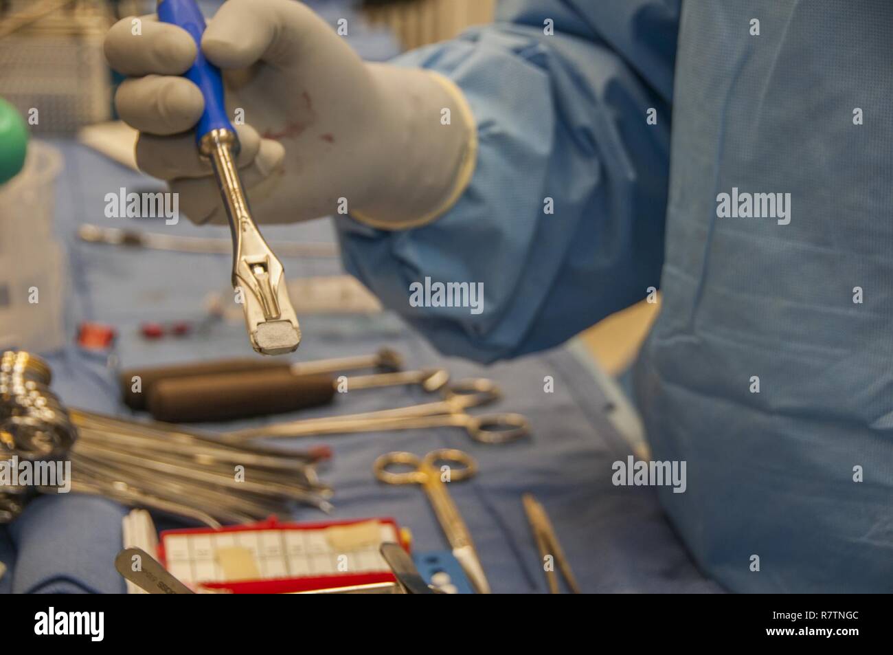 A prosthetic cervical disc is shown during a multilevel hybrid cervical ...