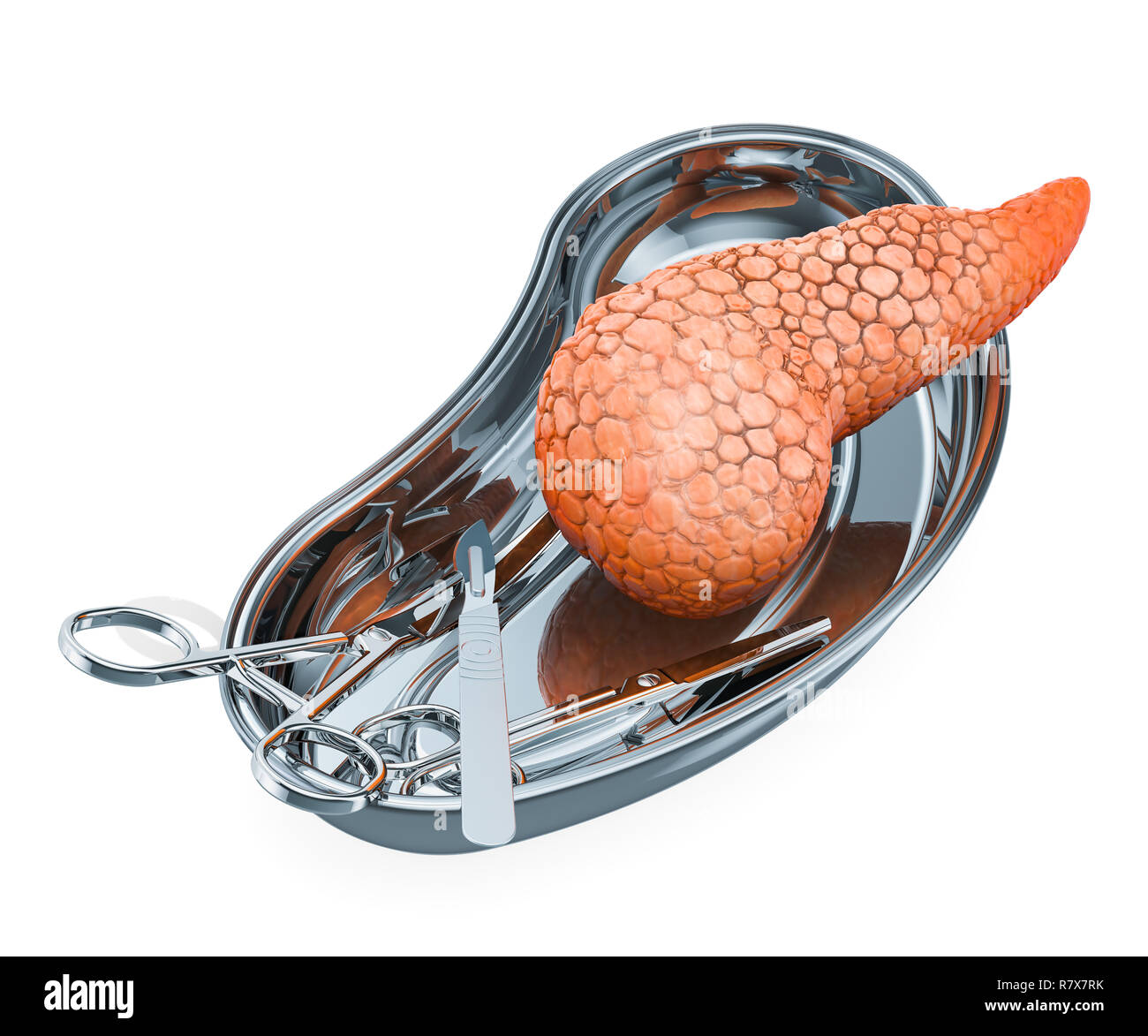 Pancreatic operation or transplantation concept. 3D rendering isolated ...