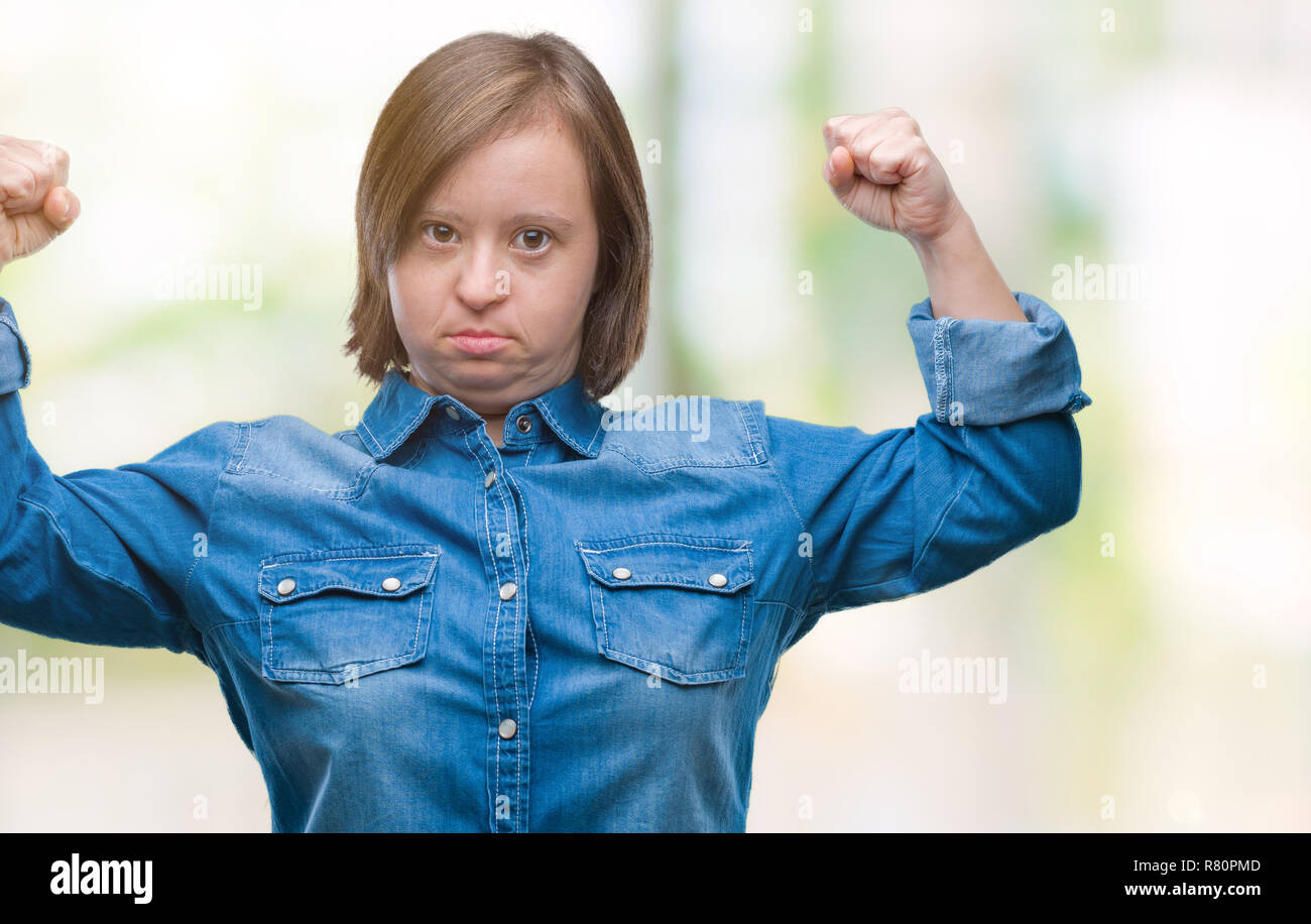 Young adult woman with down syndrome over isolated background showing ...
