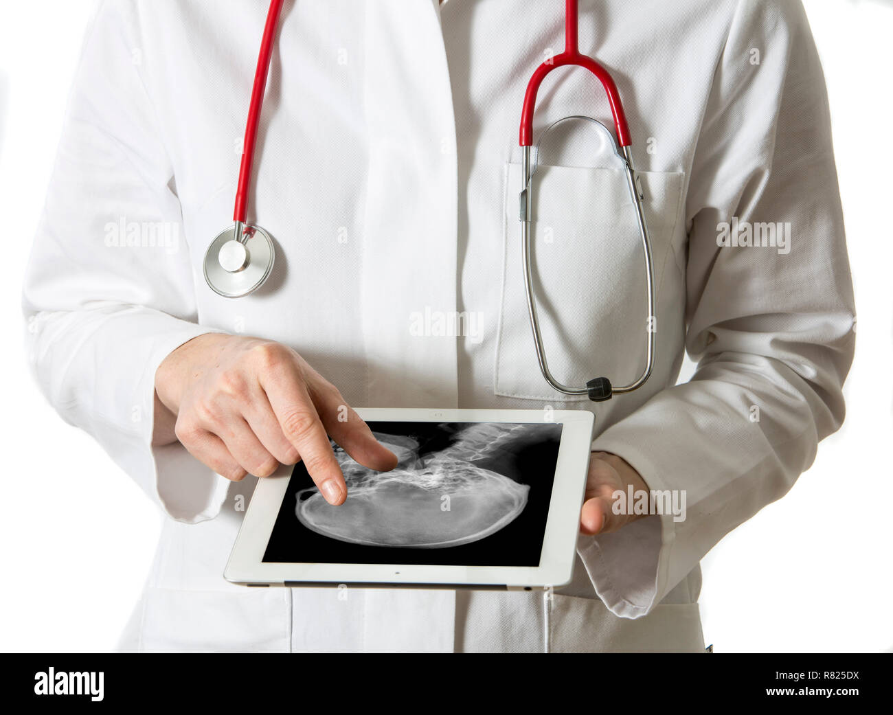 Female doctor holding a tablet computer, iPad, with an X-ray of a human ...