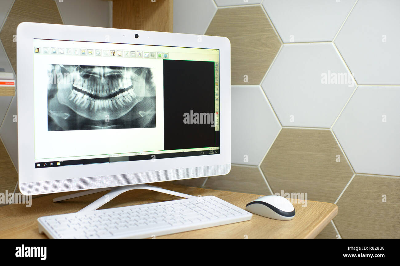 Computer x ray hi-res stock photography and images - Alamy