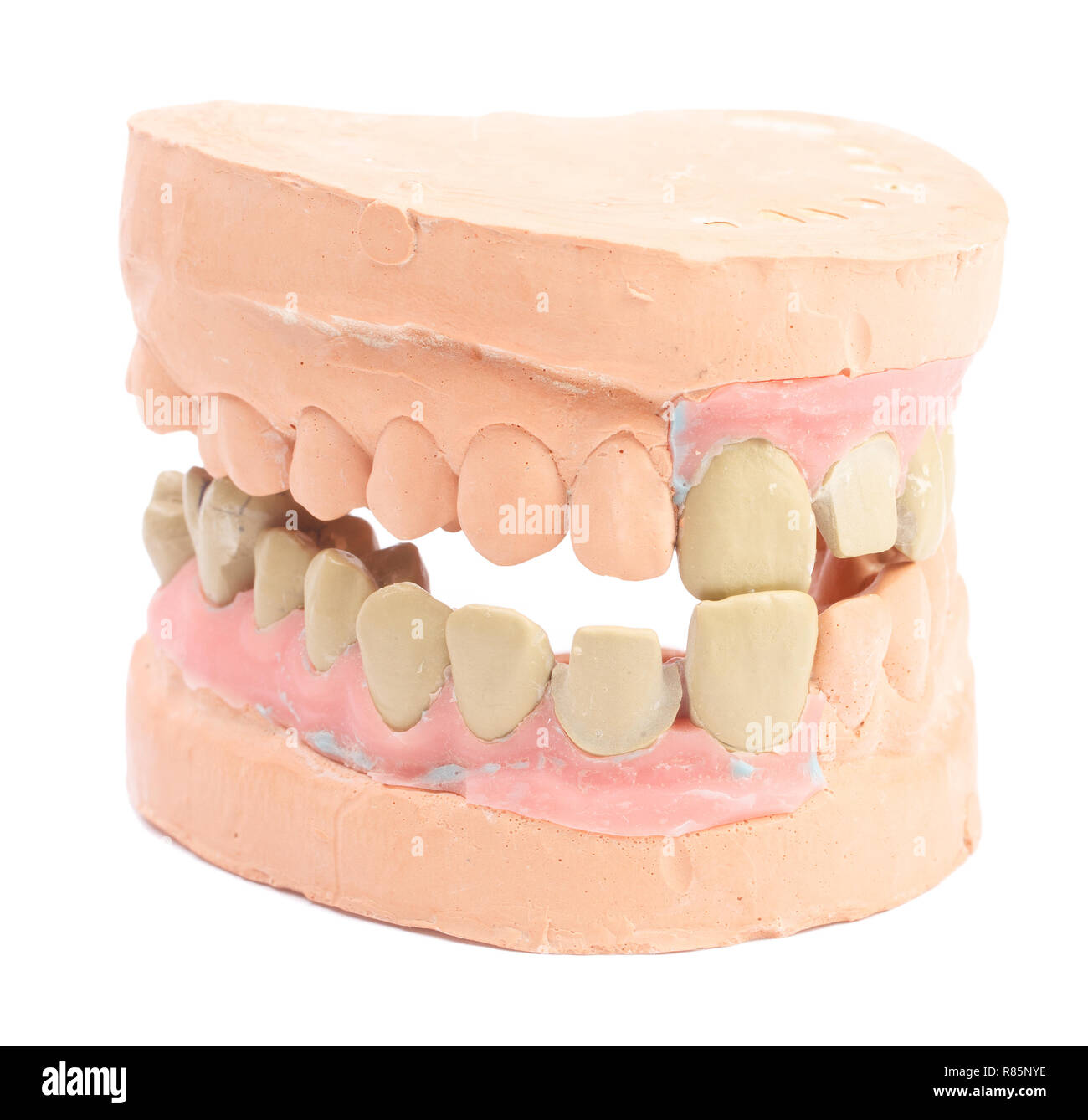 Denture isolated on white Stock Photo - Alamy