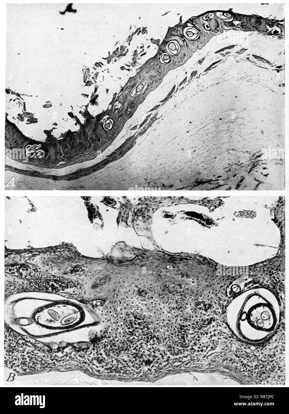 Capillaria hi-res stock photography and images - Alamy