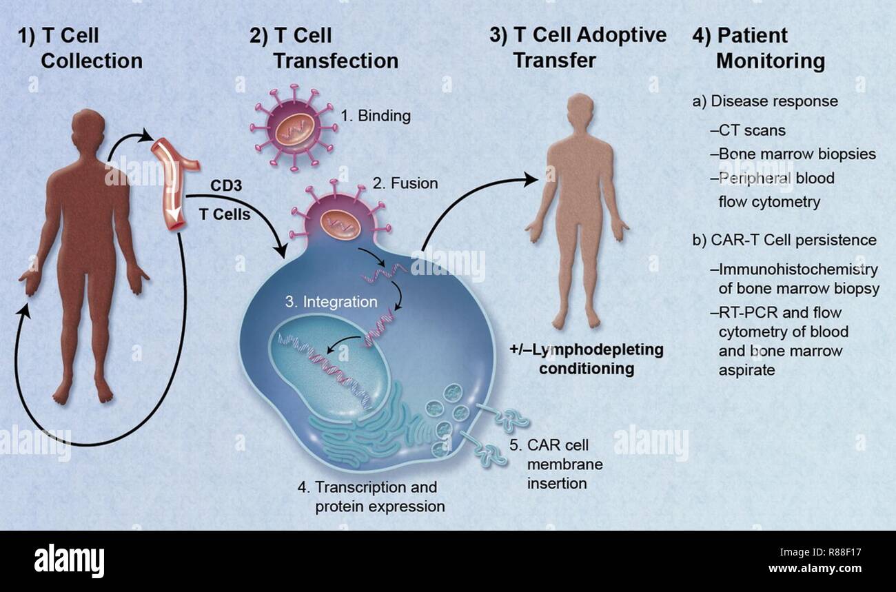 CAR-Engineered T-Cell Adoptive Transfer Stock Photo - Alamy
