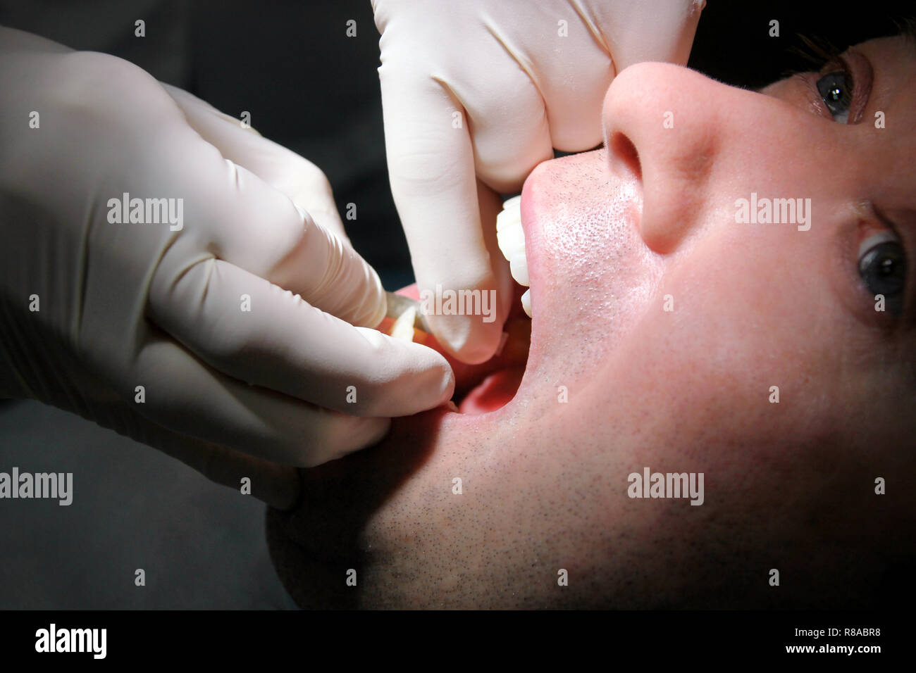 Dental file strip for teeth cleaning, dental hygiene. Dentist at work ...