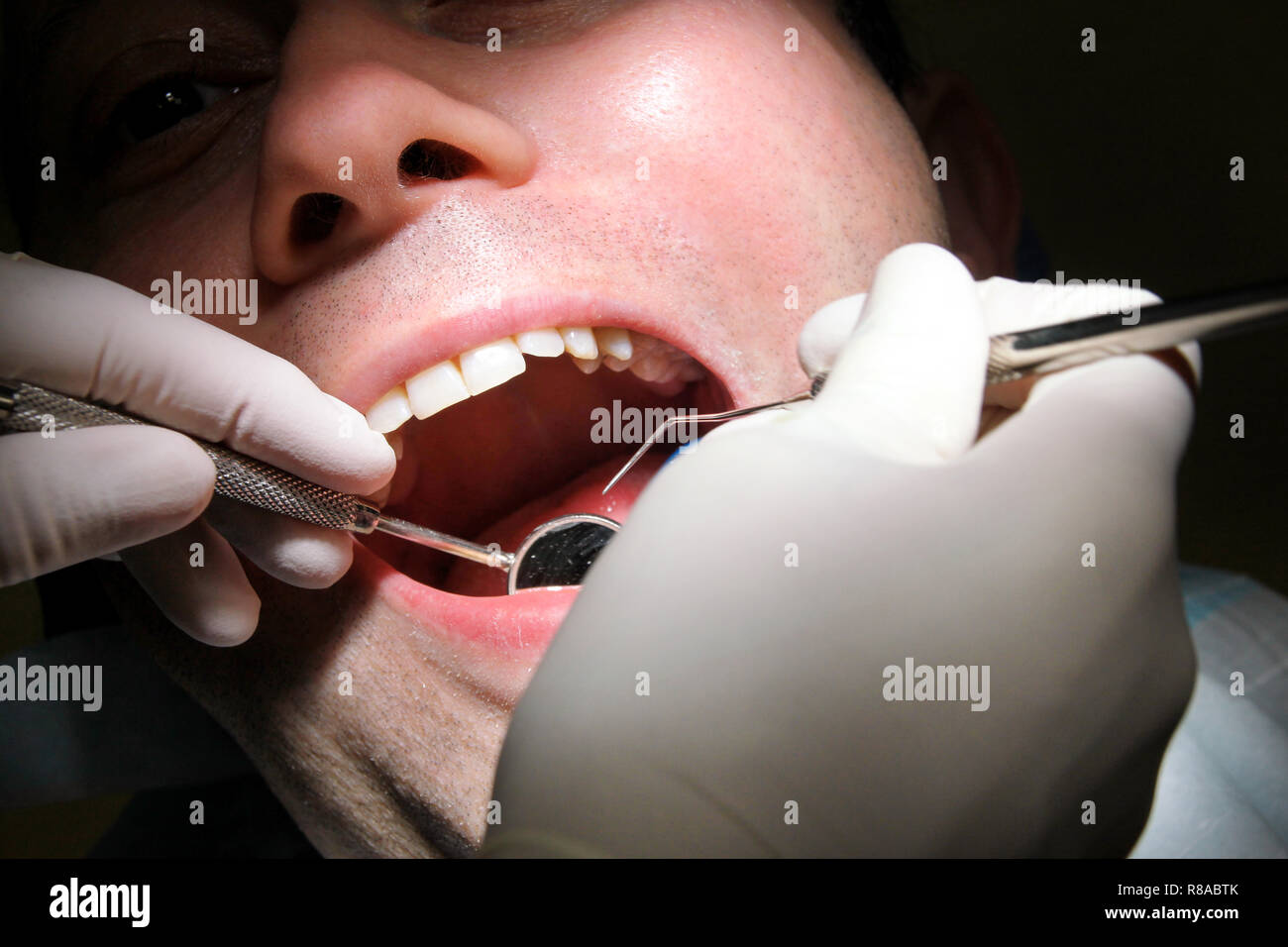 Dental check up. Dental checkup with dental tools probe, mirror and ...