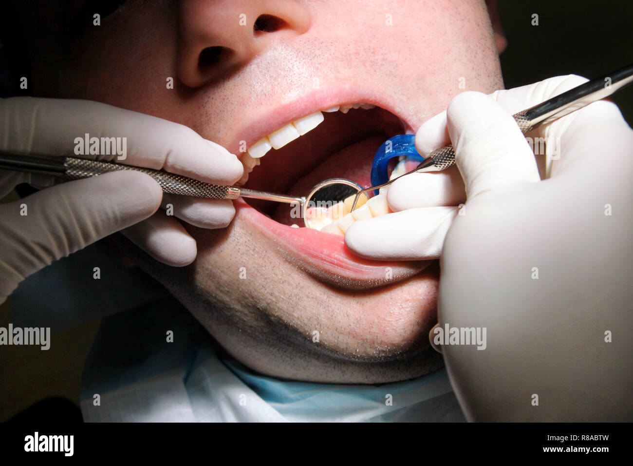 Dental check up. Dental checkup with dental tools probe, mirror and ...
