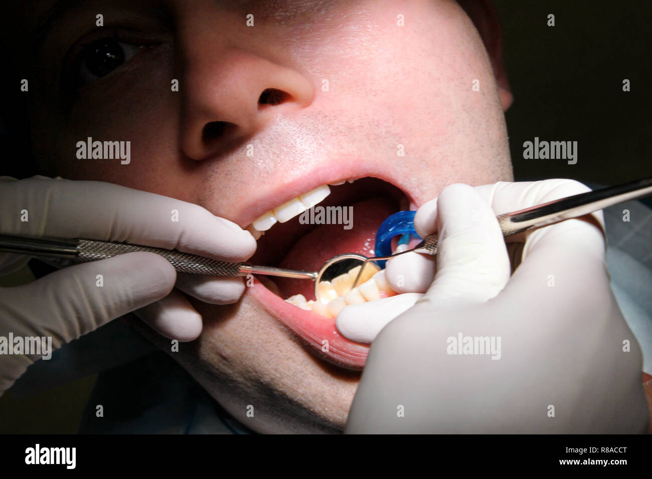 Dental check up. Dental checkup with dental tools probe, mirror and ...