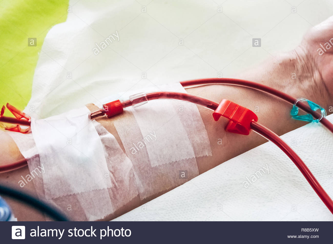 Shunt High Resolution Stock Photography and Images - Alamy