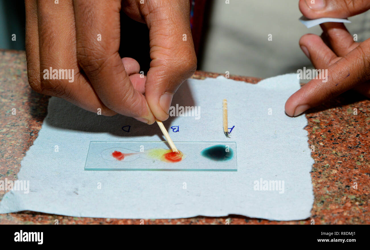 Blood testing in Laboratory Stock Photo - Alamy