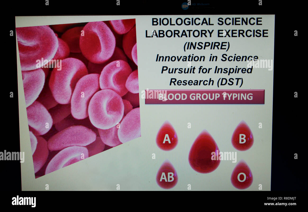 Procedure - Blood typing Stock Photo - Alamy