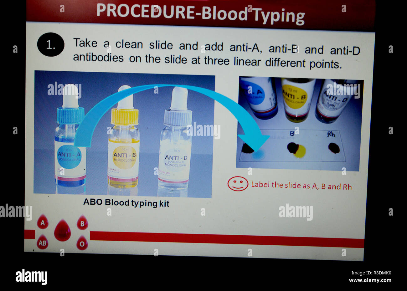 Procedure - Blood typing Stock Photo - Alamy